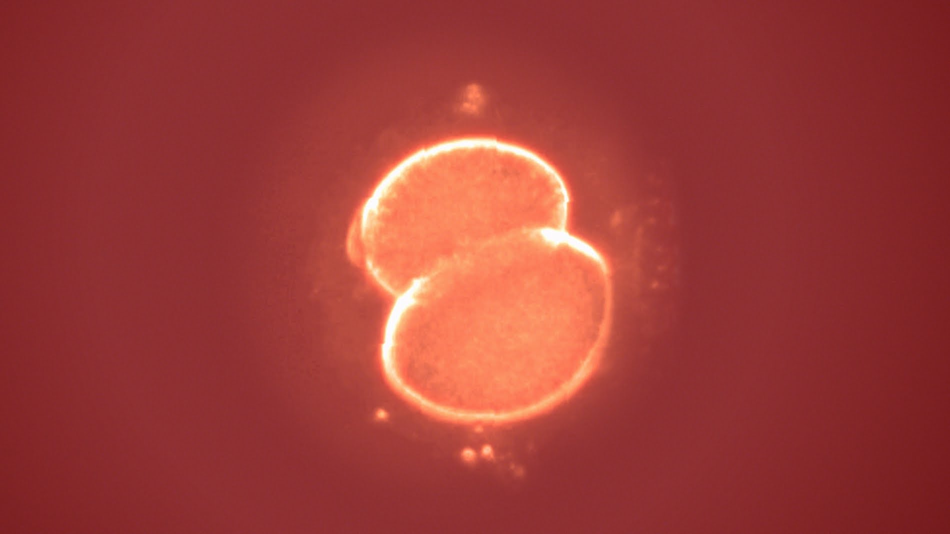 The KQED Series 'Deep Look' Explores Which Human Embryos Are Most ...