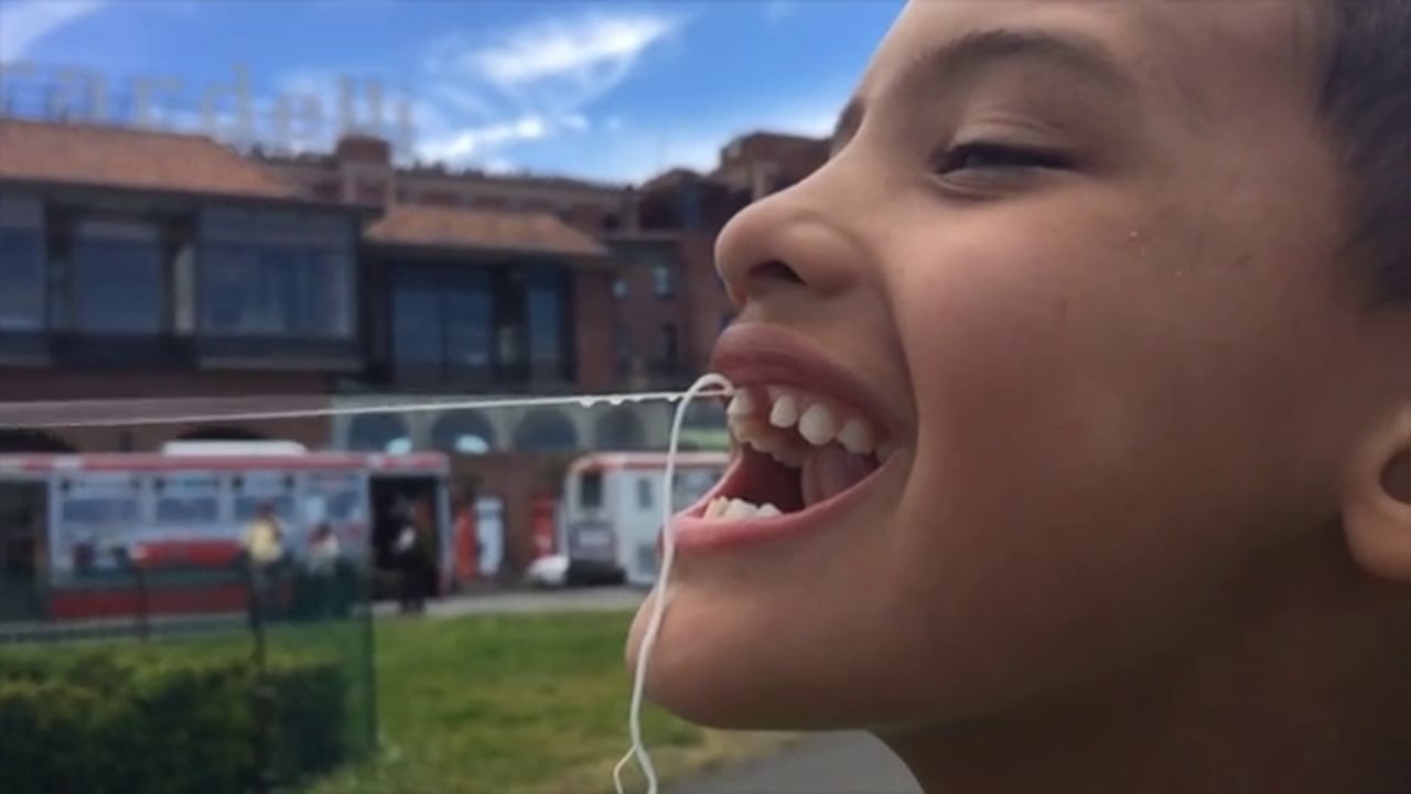 A Brave Young Boy Has His Tooth Pulled by a Drone Piloted by His Uncle