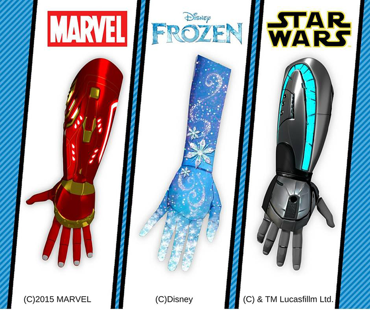 Company Creates Disney-Themed Bionic Prosthetic Hands for Young Amputees
