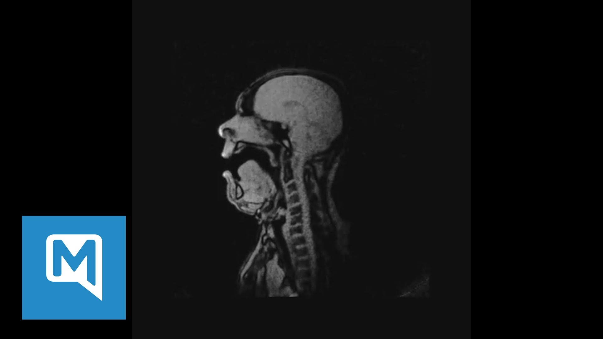 Opera Singer Flawlessly Performs a Wagner Aria While Undergoing an MRI Scan