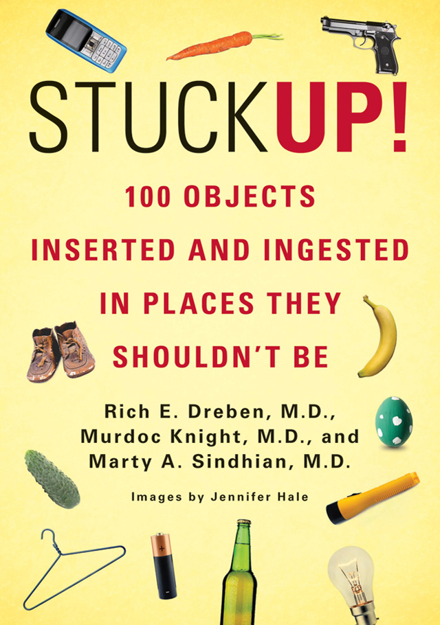 Stuck Up!: 100 Objects Inserted & Ingested in Places They Shouldn't Be